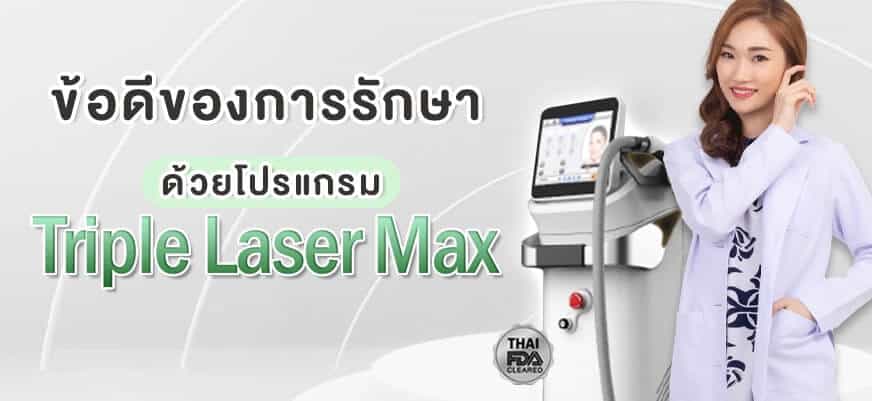 Triple Laser Max สุดยอดนวัตกรรมเลเซอร์กำจัดขน